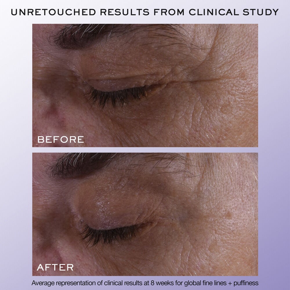 Rénergie H.C.F. Triple Eye Serum with SNK Peptide - Lancôme